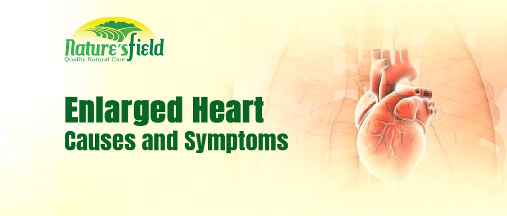 Enlarged Heart: Causes and Symptoms You Should Know - Nature'sfield ...
